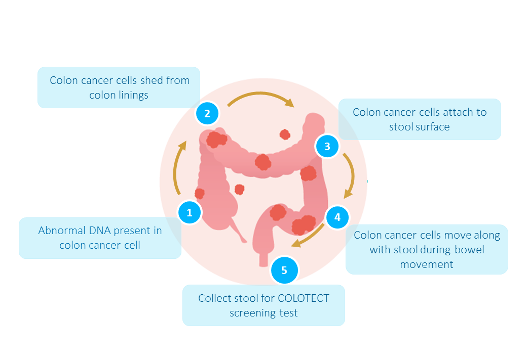 COLOTECT Colorectal Cancer Screening Test – Bumi Genomics
